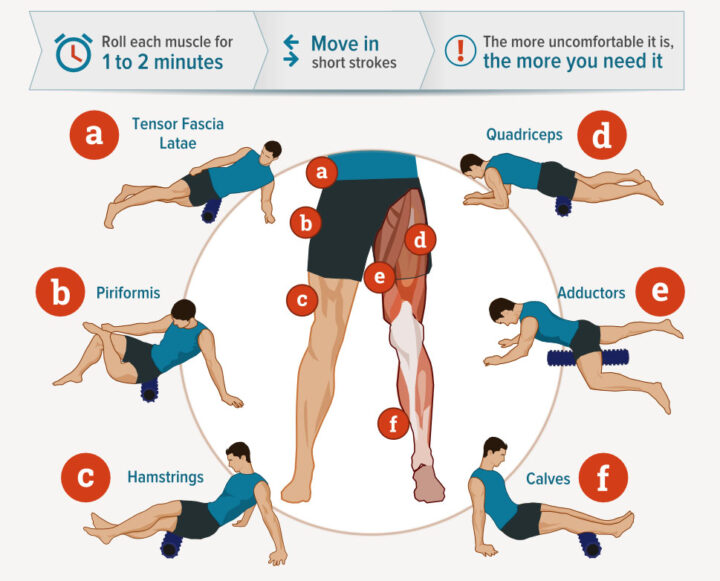 Patellofemoral Pain Syndrome: Symptoms, Causes and Treatment