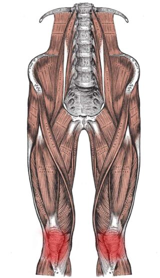 Patellofemoral Pain Syndrome: Symptoms, Causes and Treatment