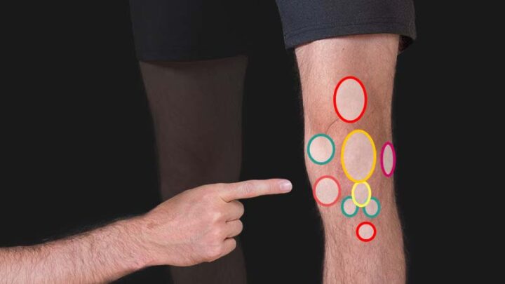 Patellar Tendonitis Pain Location & Quick Self-Test